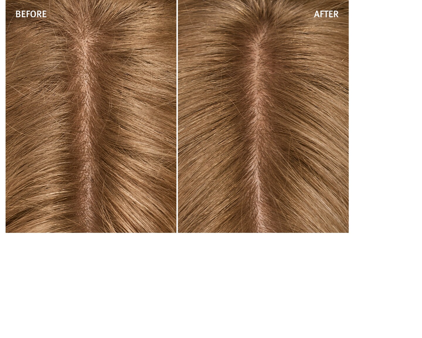 Scalp Solutions Hair Treatments for Dry Scalp | Aveda