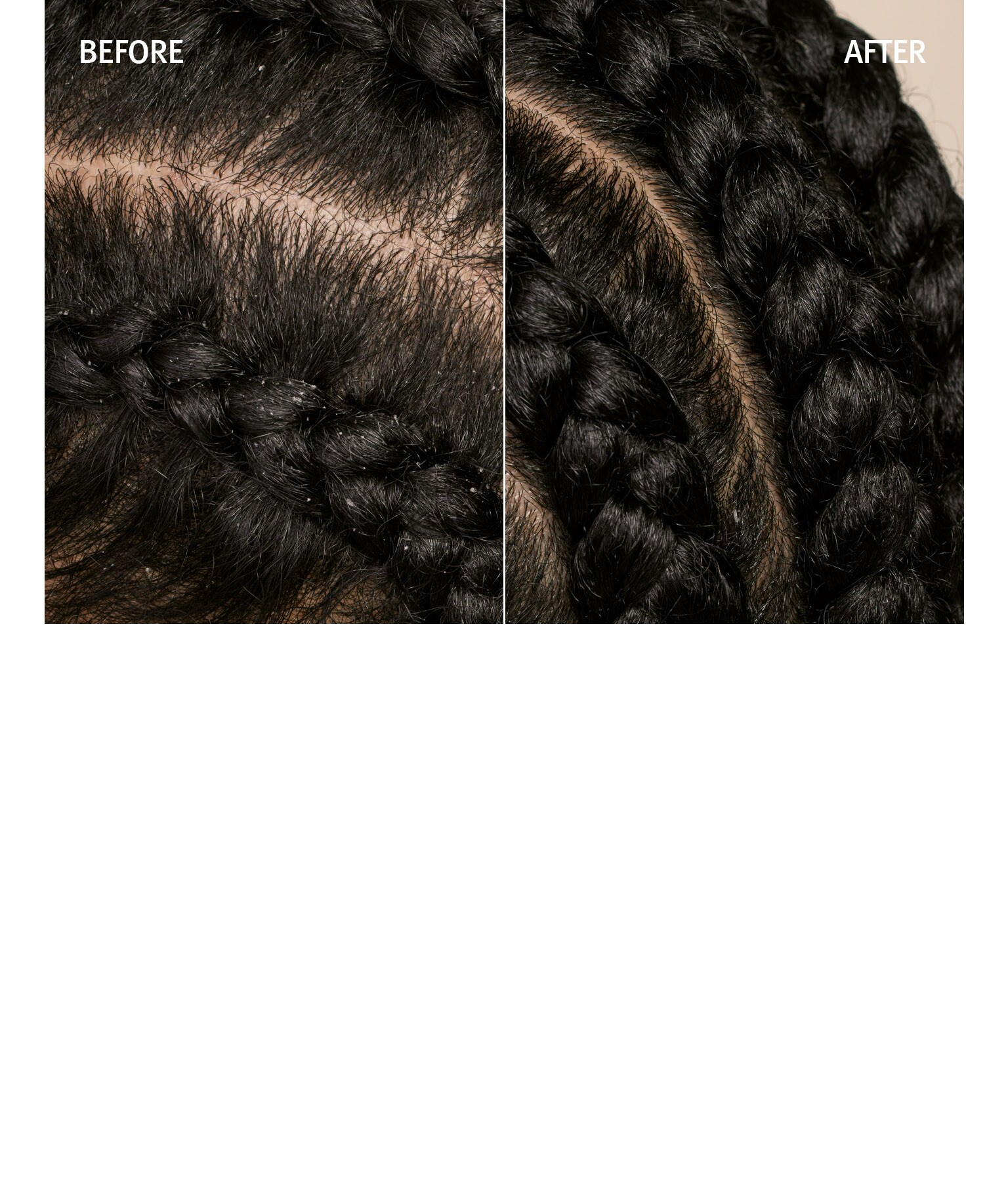 Scalp Solutions Hair Treatments for Dry Scalp | Aveda